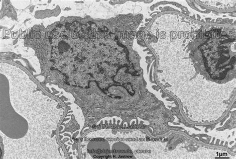 Nuclear Membrane Drjastrow39s Electron Microscopic Atlas Nucleolus