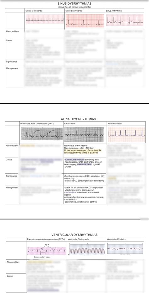 Cardiac Notes Dysrhythmias Conduction Antiarrhythmics Etc Etsy