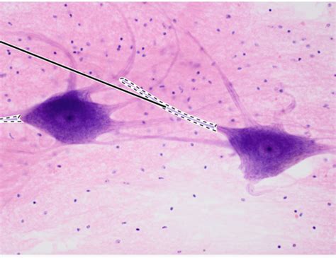 Anatomy Lab Exam 3 Flashcards Quizlet