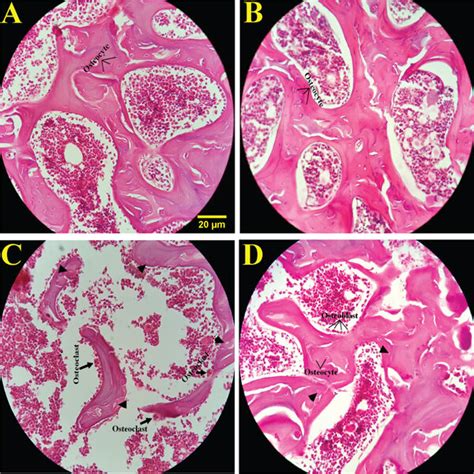 Qualitative Analysis Of The Osteocytes Osteoblasts And Osteoclast