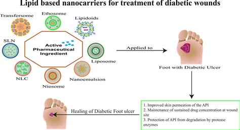 Diabetic Foot Diagram