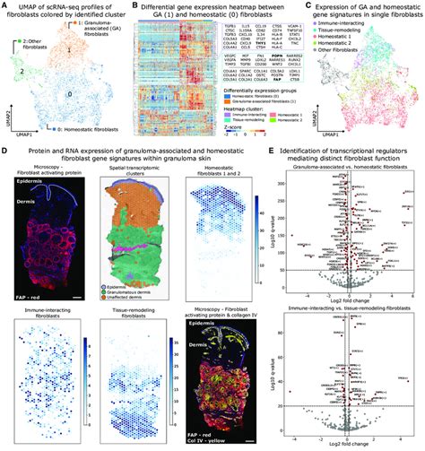 Structural Cells Promote Local Inflammation And Tissue Remodeling In
