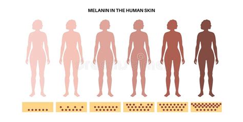 Degree Of Pigmentation From Light To Dark Stock Illustration Illustration Of Melanocyte