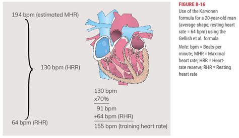 Artificial Cardiac Pacemaker Ranatomy