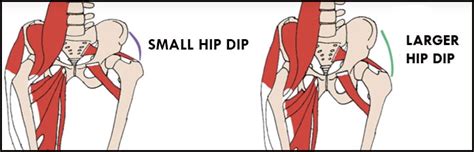 What Is A Hip Dip And What To Wear When You Have Hip Dips Inside Out Style