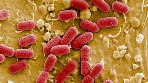 El Universo Bajo el Microscopio Estas son las bacterias más peligrosas
