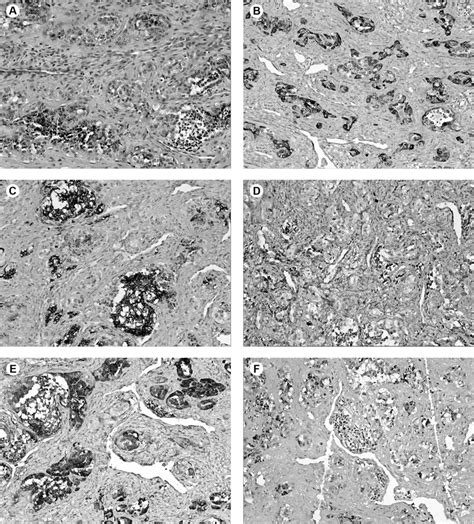 Photomicrographs Of Histological And Immunohistochemical Findings