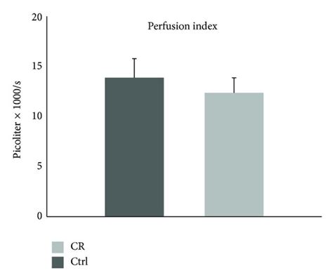 Intravital Fluorescence Microscopic Examination Of Sinusoids Of Download Scientific Diagram