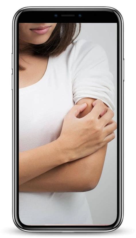 Tratamiento Para La Dermatitis En Madrid Dermaniac Clínica Dermatológica Y Estética