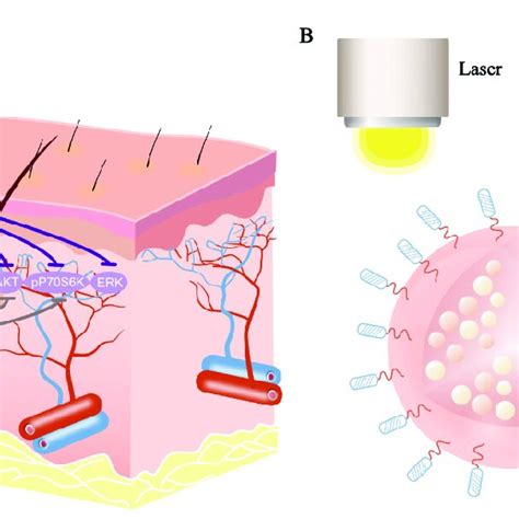 Antiangiogenic Agents Combined With Pdl And A Novel Pdt For Treatment