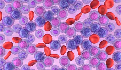 Glycomimetics Reports Data From Phase Iii Aml Treatment Trial