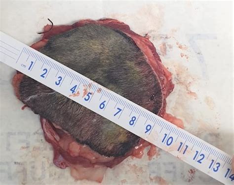 Fibrosarcom Si Excizie De Perete Abdominal Si Toracic La Pisica