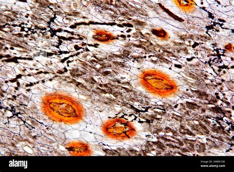 Epithelium Simple Squamous Photomicrograph X150 At 10 Cm Wide Stock