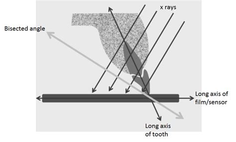 Radiographic Technique Maxillary Occlusal Radiographs Dr Gs Toothpix