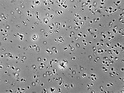 Lactobacillus Plantarum Colony Morphology