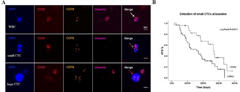 Analysis Of Ctcs Based On Cell Size And Correlation Of Small Cell Ctcs