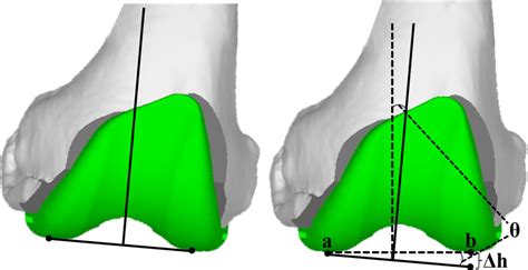Schematic Diagram Of The Relationship Between Gap And Alignment By Download Scientific Diagram