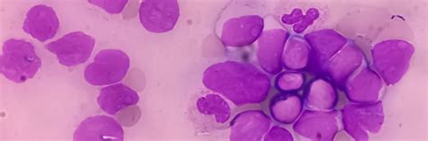 A Novel Cell Wall Polysaccharide Derived From The Stipe Of Agaricus