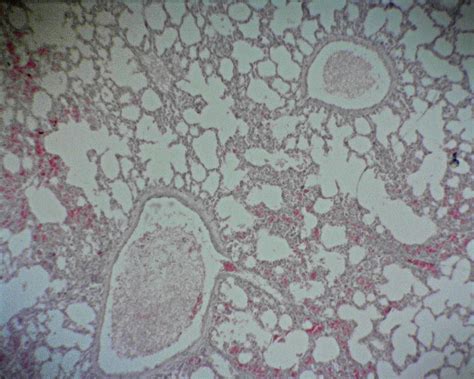 B A Philip Harris Prepared Microscope Slide Lung For Elastic And Collagen Fibres Of