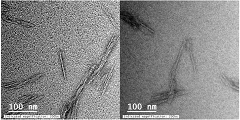 Transmission Electron Microscopy Tem Micrographs Of Download