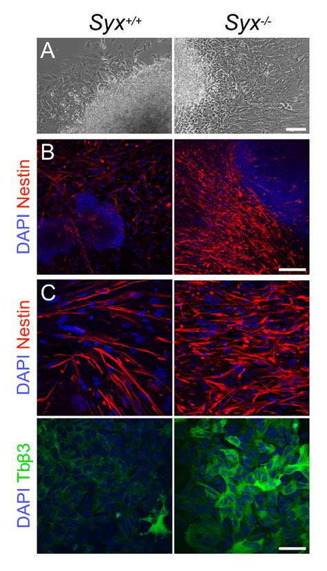 Analysis Of Retinoic Acid Induced Neural Differentiation Of Mouse