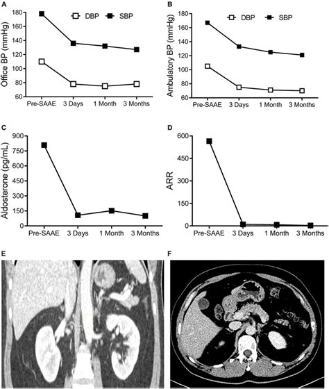 The Effects Of Superselective Adrenal Arterial Embolization Saae