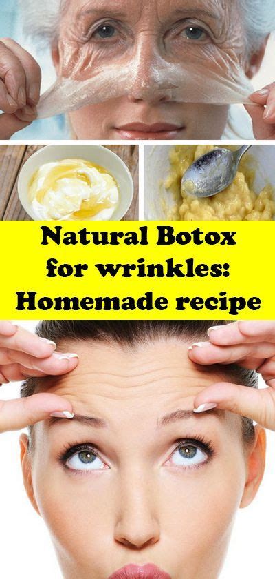 Natural Botox For Wrinkles Homemade Recipe Natural Botox Botox Wrinkles Botox