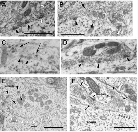 Figure 6 From The Soma And Proximal Dendrites Of Sympathetic Preganglionic Neurons Innervating
