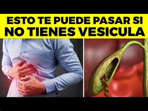Todo lo que debes saber sobre qué pasa si te quitan la vesícula causas