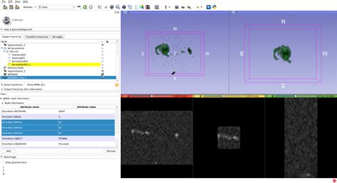 Documentation Nightly Modules AstroMasking Slicer Wiki