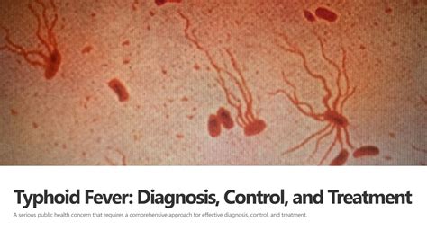 Typhoid And Its Causes Epidemiology And Spread Pptx