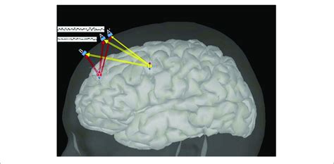 Effects Of Sources On EEG Sensors The Dependence On The Electric Download Scientific Diagram