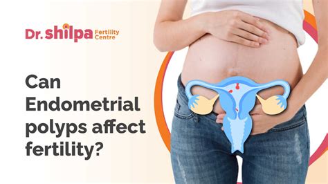 Can Endometrial Polyps Affect Fertility Dr Shilpa Gb