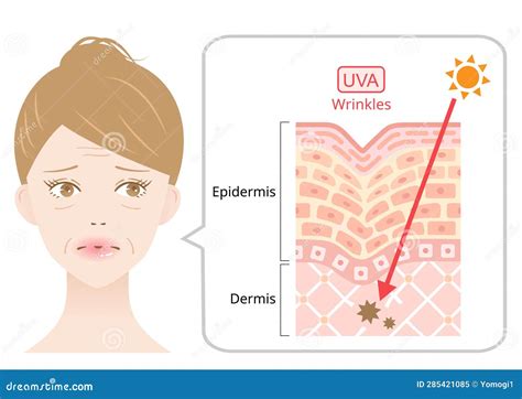 Uva Radiation Penetrate Into Skin On Woman S Face That Is Resulting In