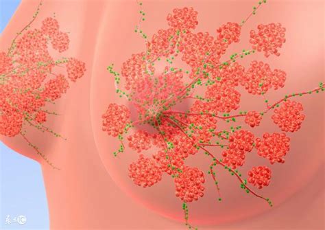 急性乳腺炎在不同時期不同症狀 乳腺炎症狀不能忽視 每日頭條