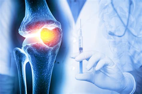 Orthopedic Surgeons Recommend Prp Therapy Before Surgery All Star