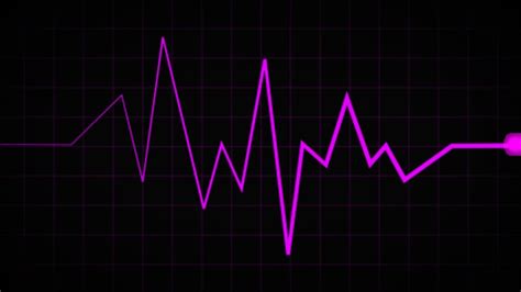 심전도의 정상적인 심장 박동 선 부비동 리듬 Ecg Ekg 의학에서 생명 건강 관리 기호 표시 프리미엄 사진
