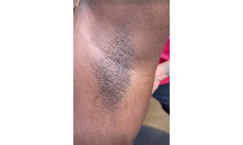 Foto Jojo Todynho Mostrou Sua Axila Peluda Em Um Vídeo Enquanto Se