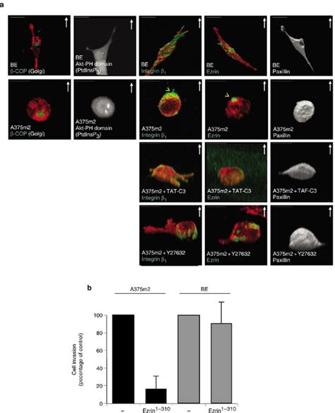 Differing Modes Of Tumour Cell Invasion Have Distinct Requirements For Rho ROCK Signalling And