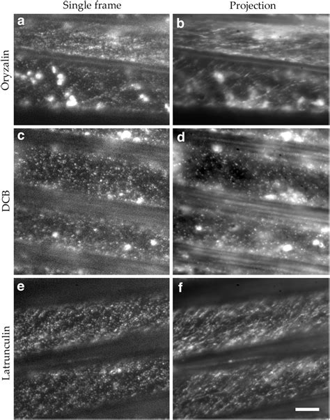 Effect Of Selected Inhibitors On Cesa Localization And Motility In B Download Scientific