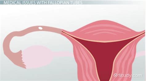 Fallopian Tube Anatomy Function And Location Video