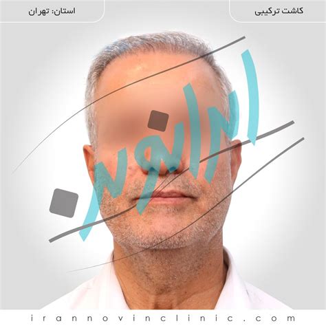 مراجعه کننده ی عزیز کلینیک ایران نوین که در این مجموعه کار انجام داده