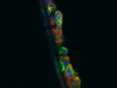 Vitroview™ Immunofluorescence Double Staining Kit Fl488 Anti Mouse
