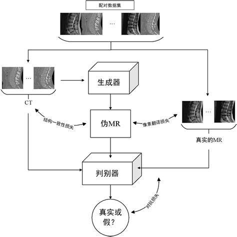 基于生成对抗性网络的脊柱ct到mr转换方法及系统