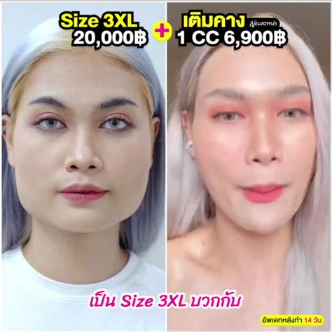 Lbc Clinic เลอบิวทิส Home