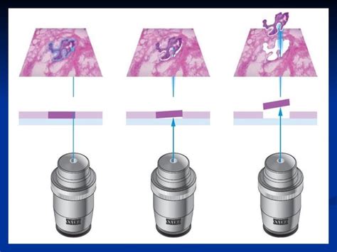 Laser Microdissection Ppt ORAL PATHOLOGY PPT
