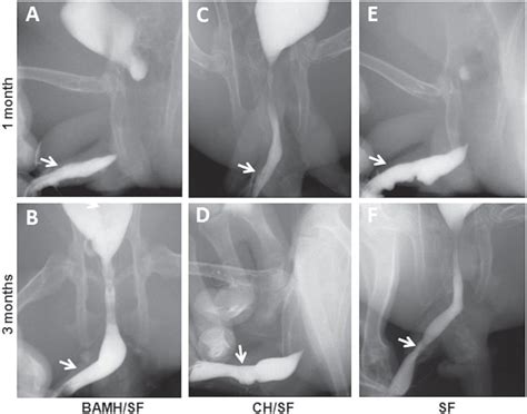Retrograde Urethrograms Of Urethras Retrieved At One And Three Months Download Scientific