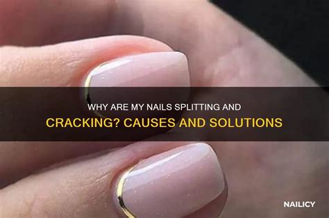 Why Are My Nails Splitting And Cracking Causes And Solutions Nailicy