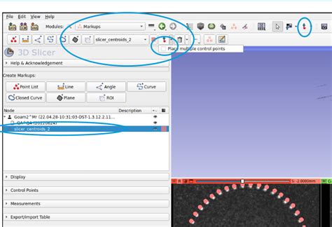 marker extraction — mri distortion toolkit documentation