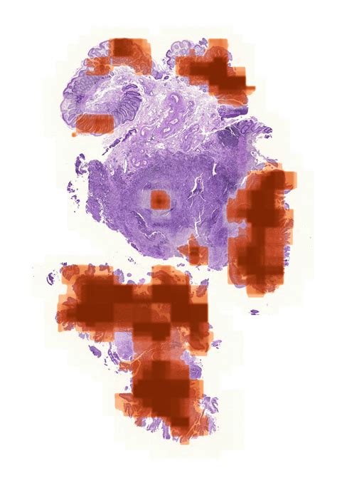 Attention Map Generated By Our Tool Download Scientific Diagram